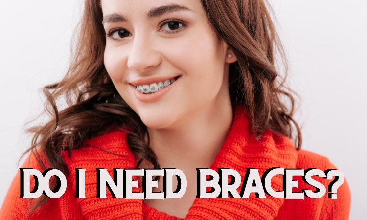Do You Need Braces? Quiz - Popular Quizz